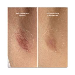 Magic Molecule The Solution Hypochlorous Acid Spray, Travel Size ...